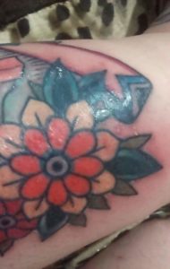 Tatuagem inflamada: causas e tratamentos